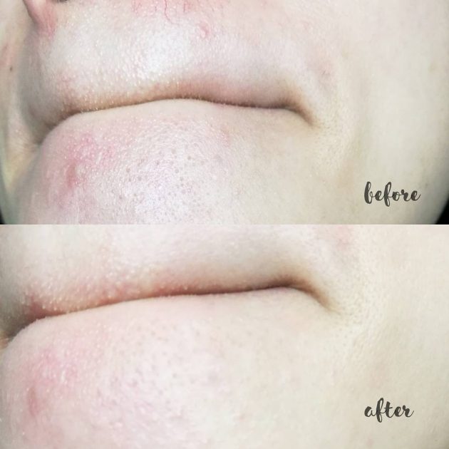 Exfolimate 新一代潔面美妝神器！罕有 Blogger 分享的好物！ - MUA 化妝師平台